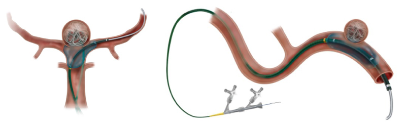 Scepter | 医療機器 | テルモメディカルナビ