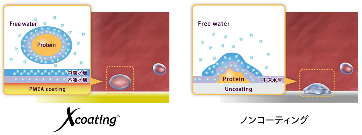 製品特徴 | DewX Eterna特徴 | 医療機器 | テルモメディカルナビ