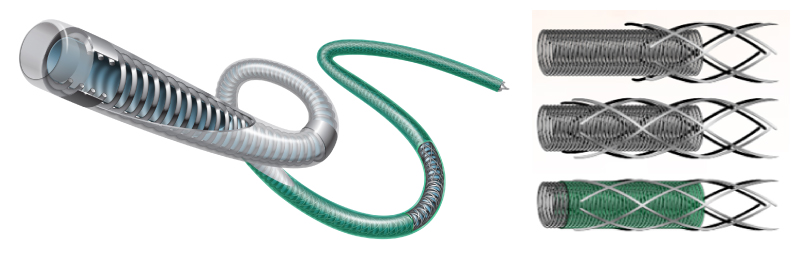 HeadwayDuo | 医療機器 | テルモメディカルナビ