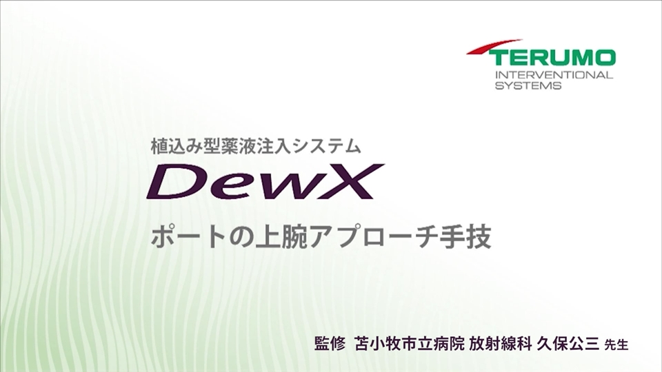 手技情報・導入事例一覧 | インターベンショナルオンコロジー・エンボリ | 領域情報 | テルモメディカルナビ