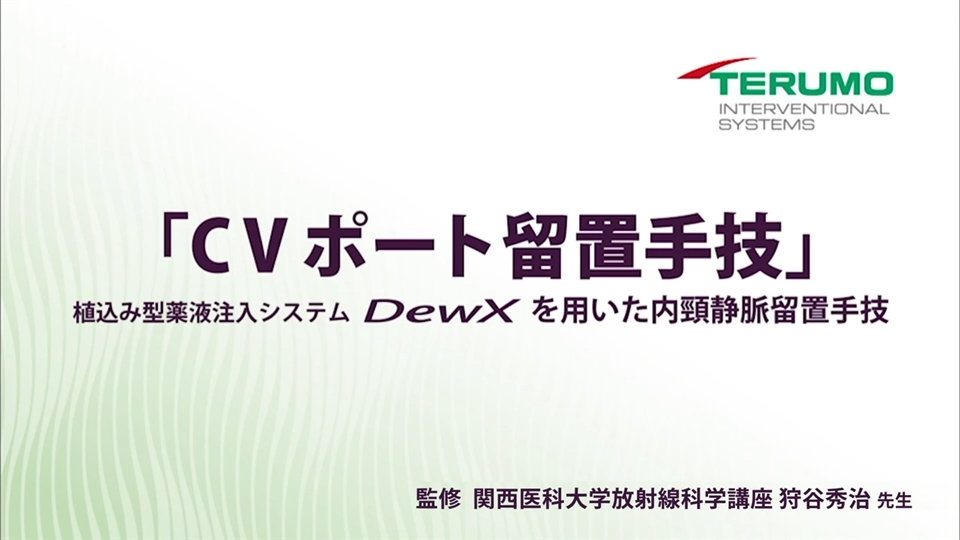 手技情報・導入事例一覧 | インターベンショナルオンコロジー・エンボリ | 領域情報 | テルモメディカルナビ